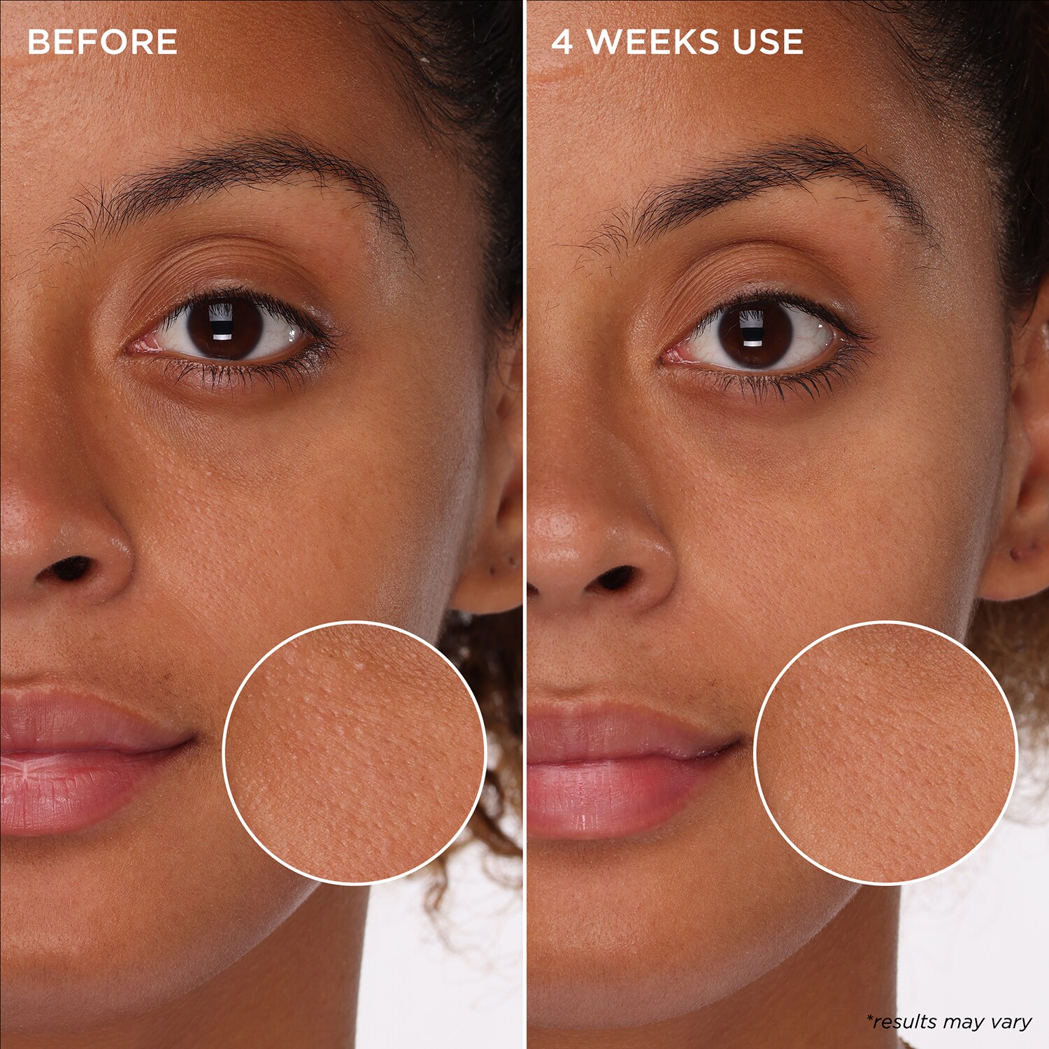 Pore Score - Coffret Soins pour les pores de BENEFIT COSMETICS ≡ SEPHORA