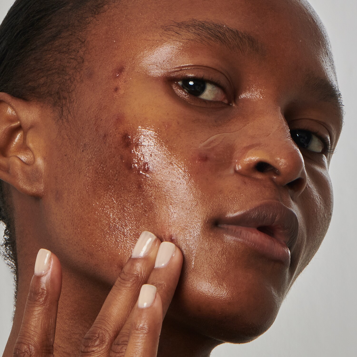 Solution contre l'excès de sébum avec du niacinamide 20 % - Sérum ...