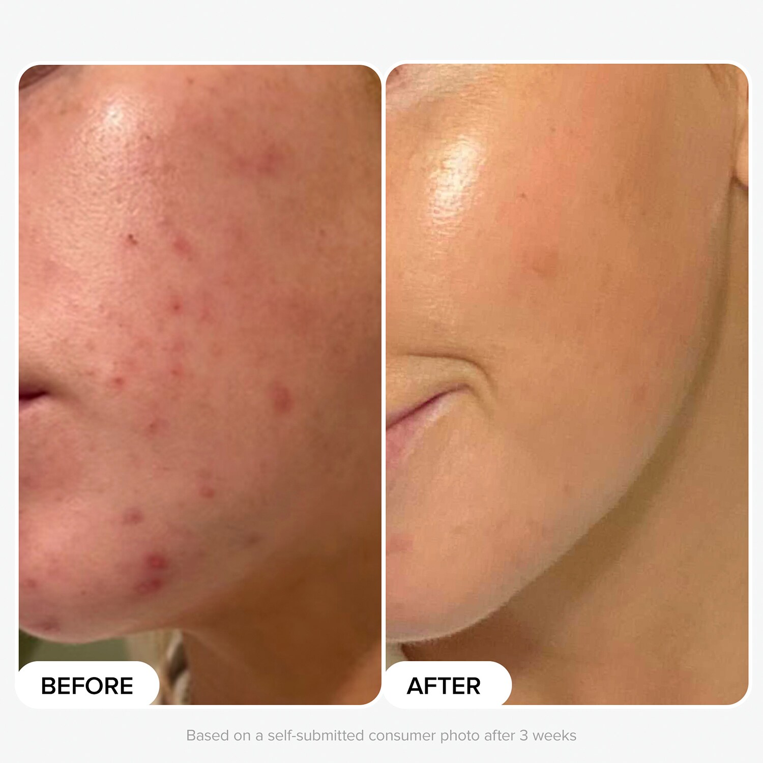 Multi-Level Exfoliation Trial Kit - Duo Découverte Exfoliants AHA + BHA ...